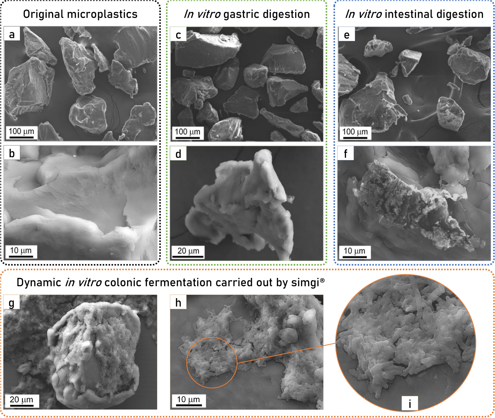 Microplastic to our gastrointestinal microbiota - Solen